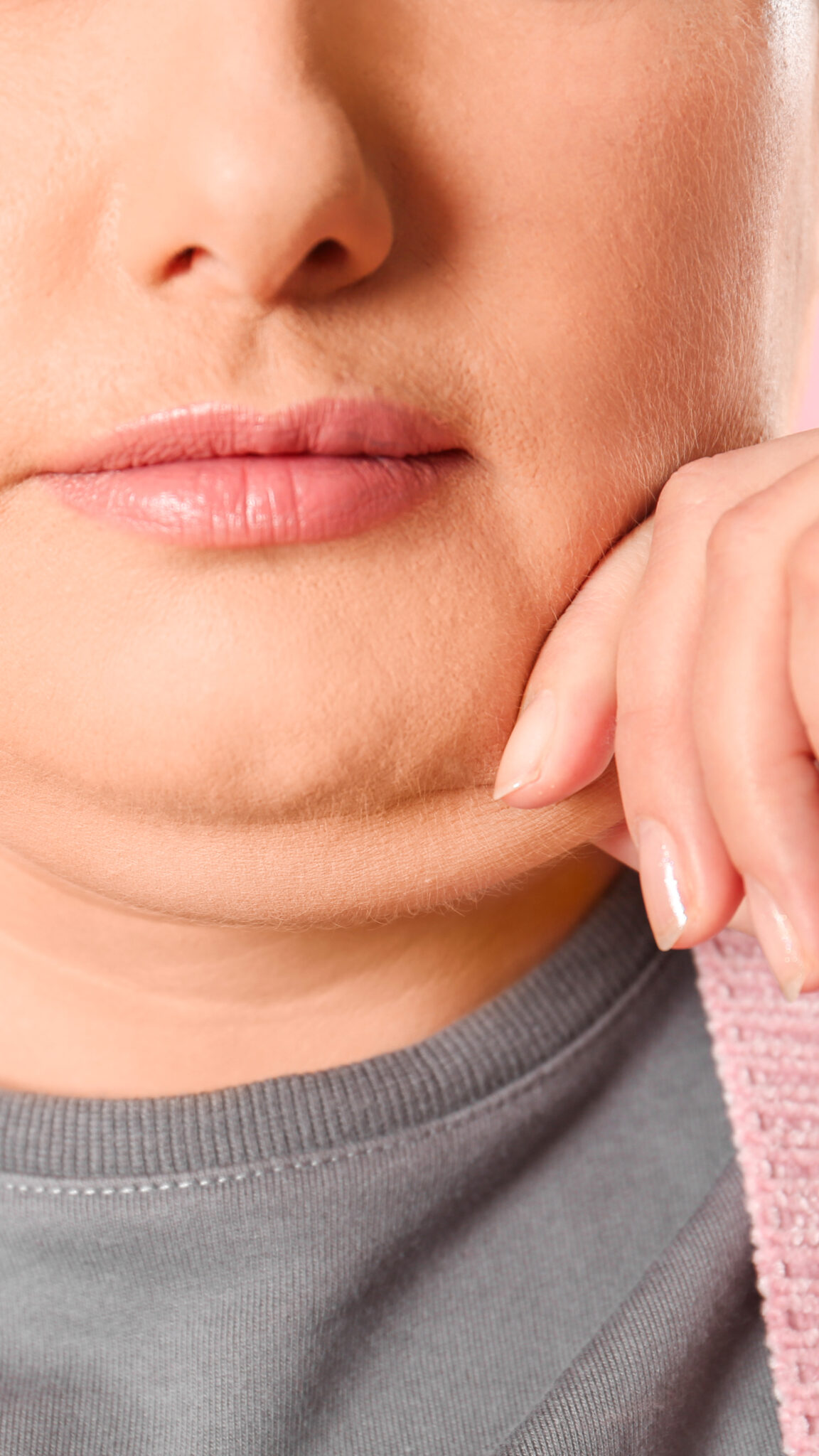 Velashape Facial - DepilTime - Parceiros na Estética